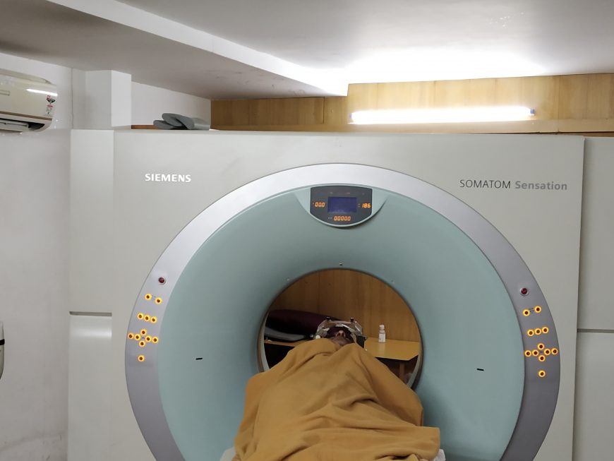 Understanding the Process of Deep Brain Stimulation (DBS) Surgery ...